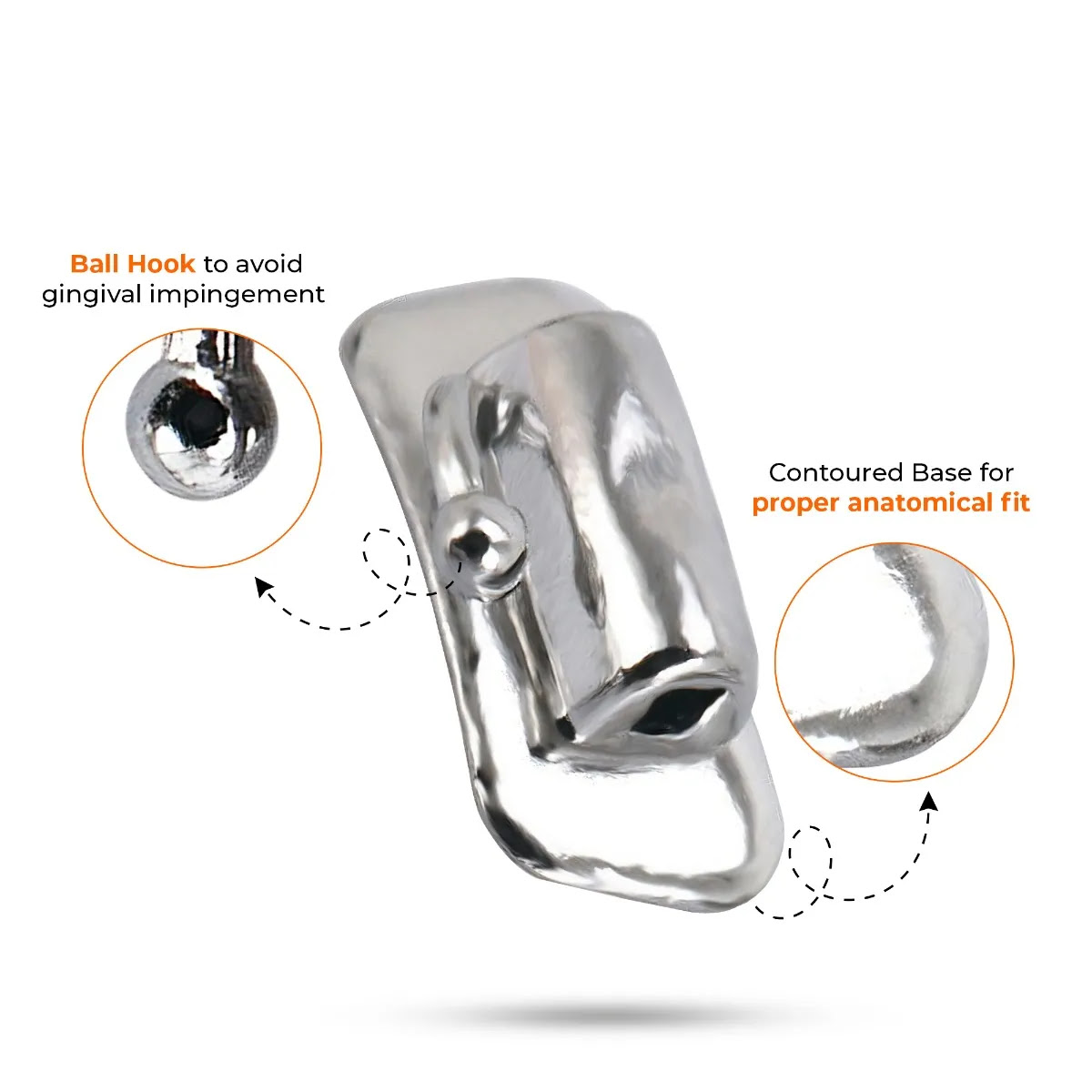 Buy U Ortho Bondable Buccal Tubes for 1st Molar MBT 0.022 Online ...