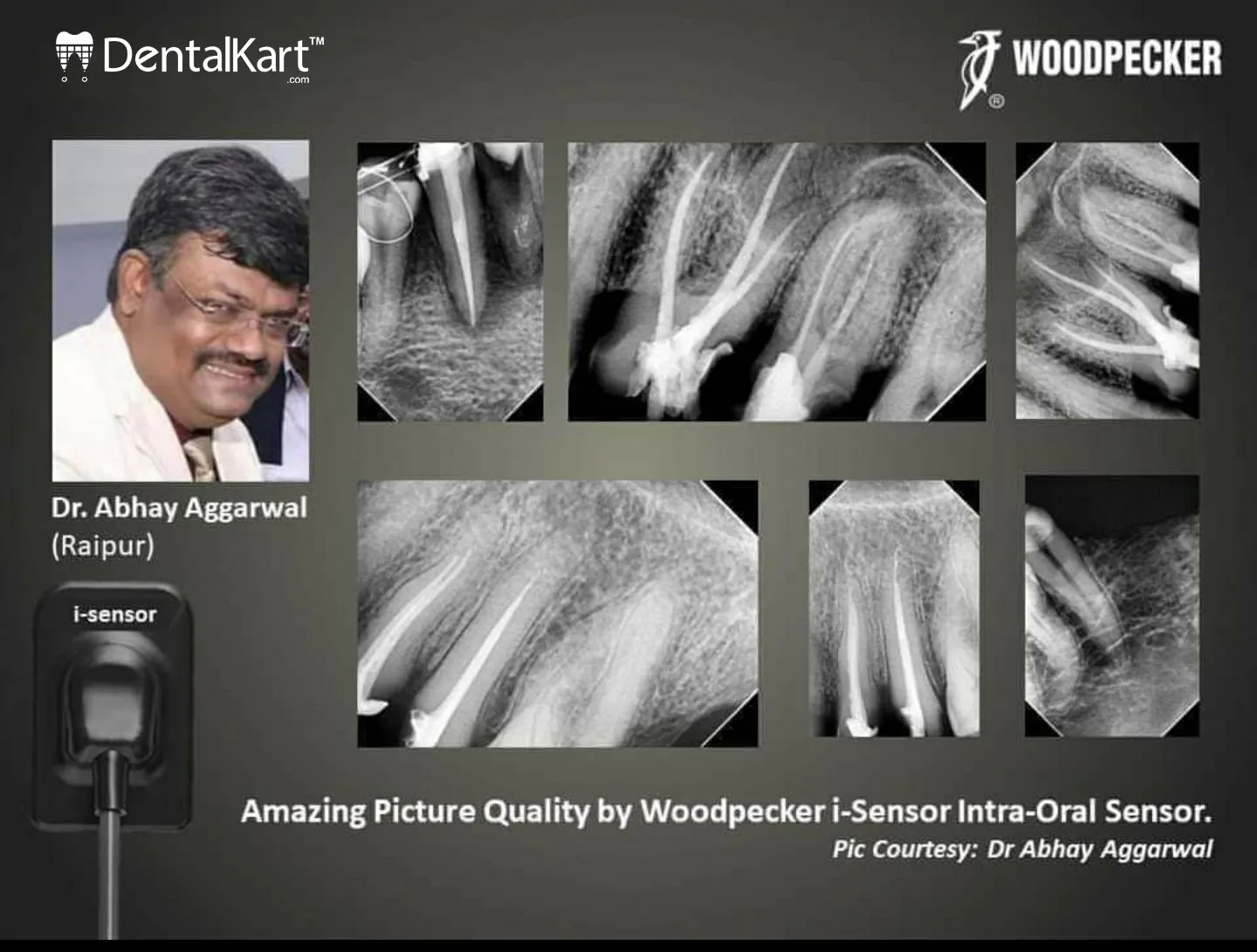 Buy Woodpecker Dental RVG i Sensor Size 1 | Top X-Ray Sensor for ...