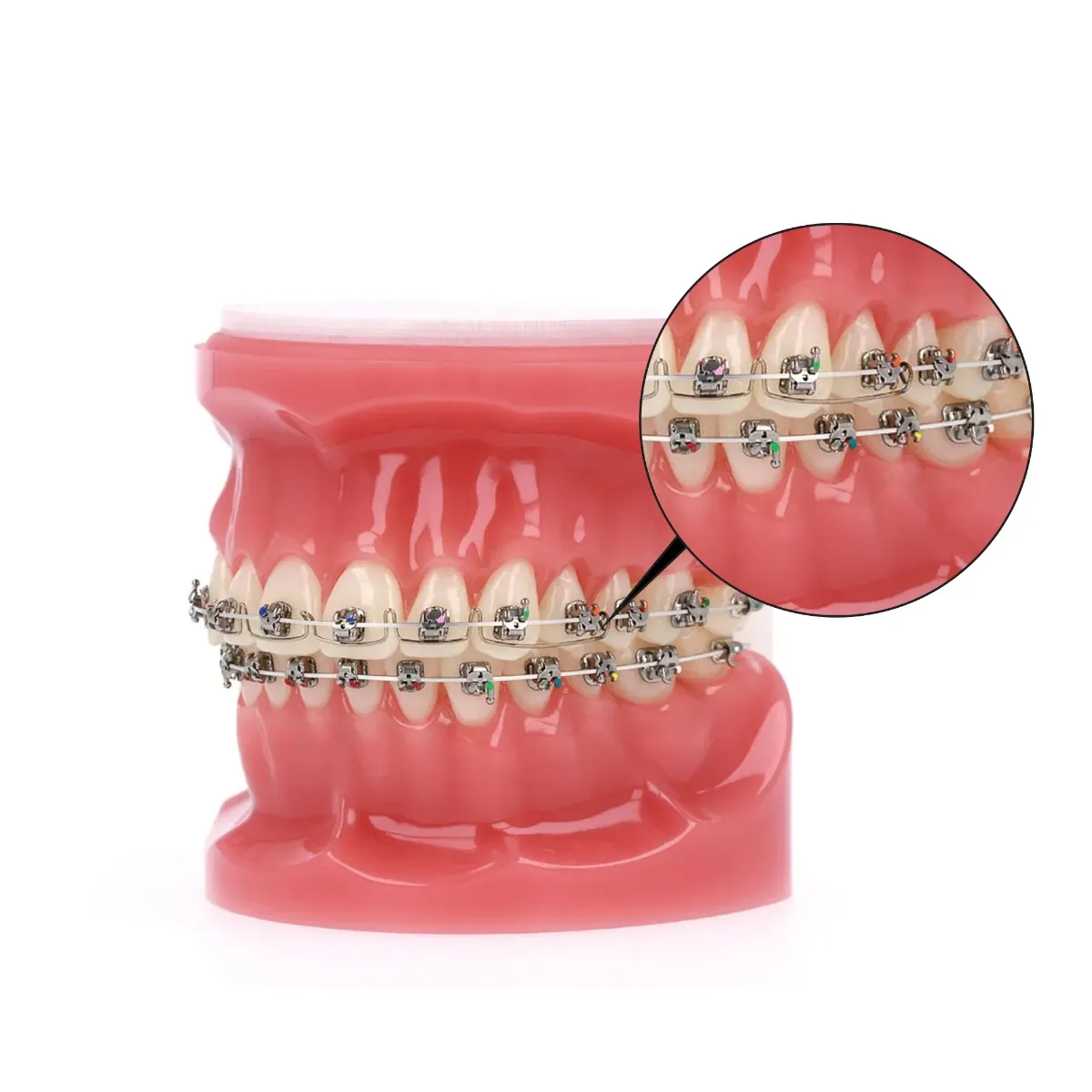 Shop UU Ortho Anterior Root Torquing Spring (10 Pcs) Online ...