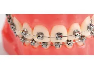 OSL Stainless Steel Ovoid Form Archwires - Rectangular