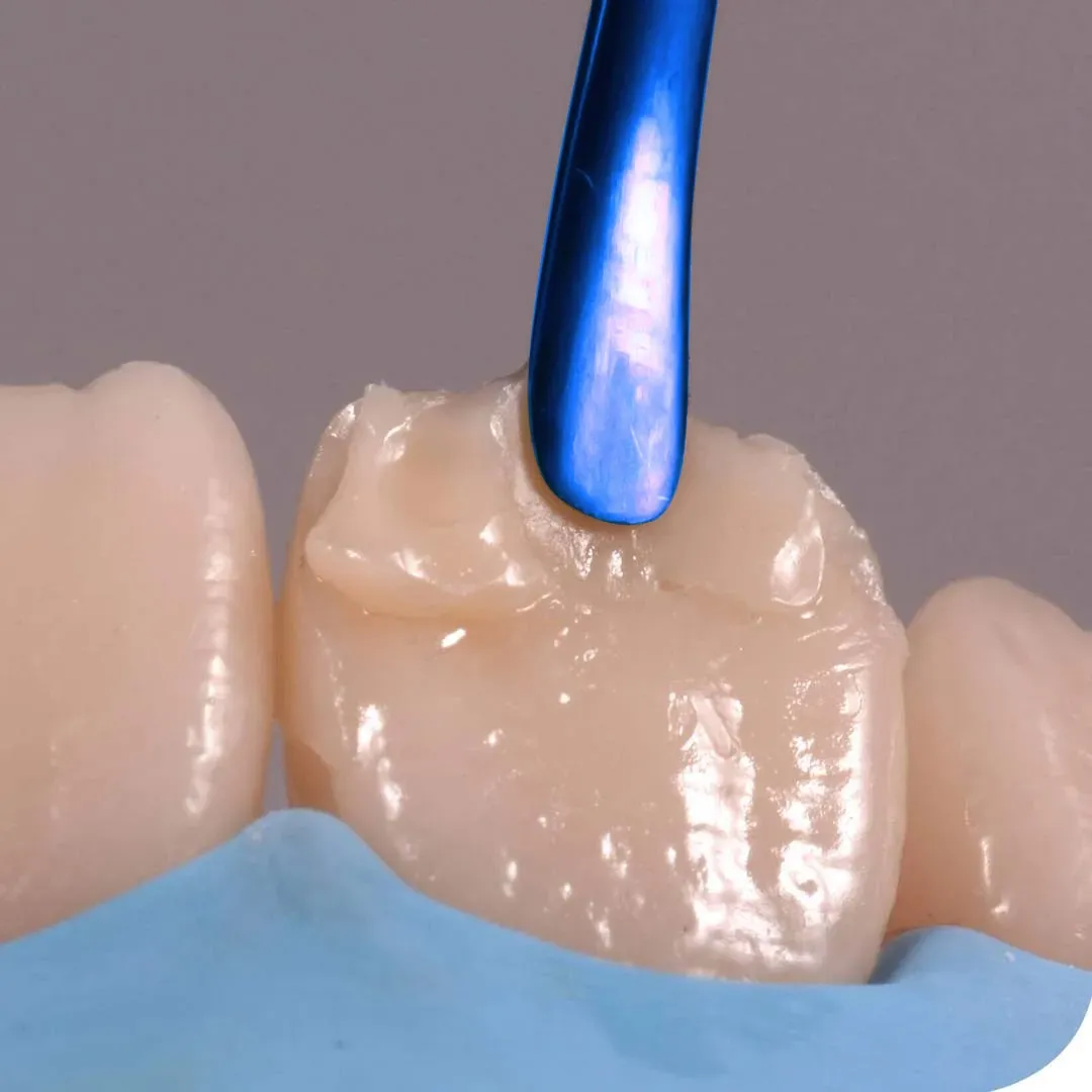 Buy DentGist NanoCom Restorative Composite Refills 4g At Best Price On ...