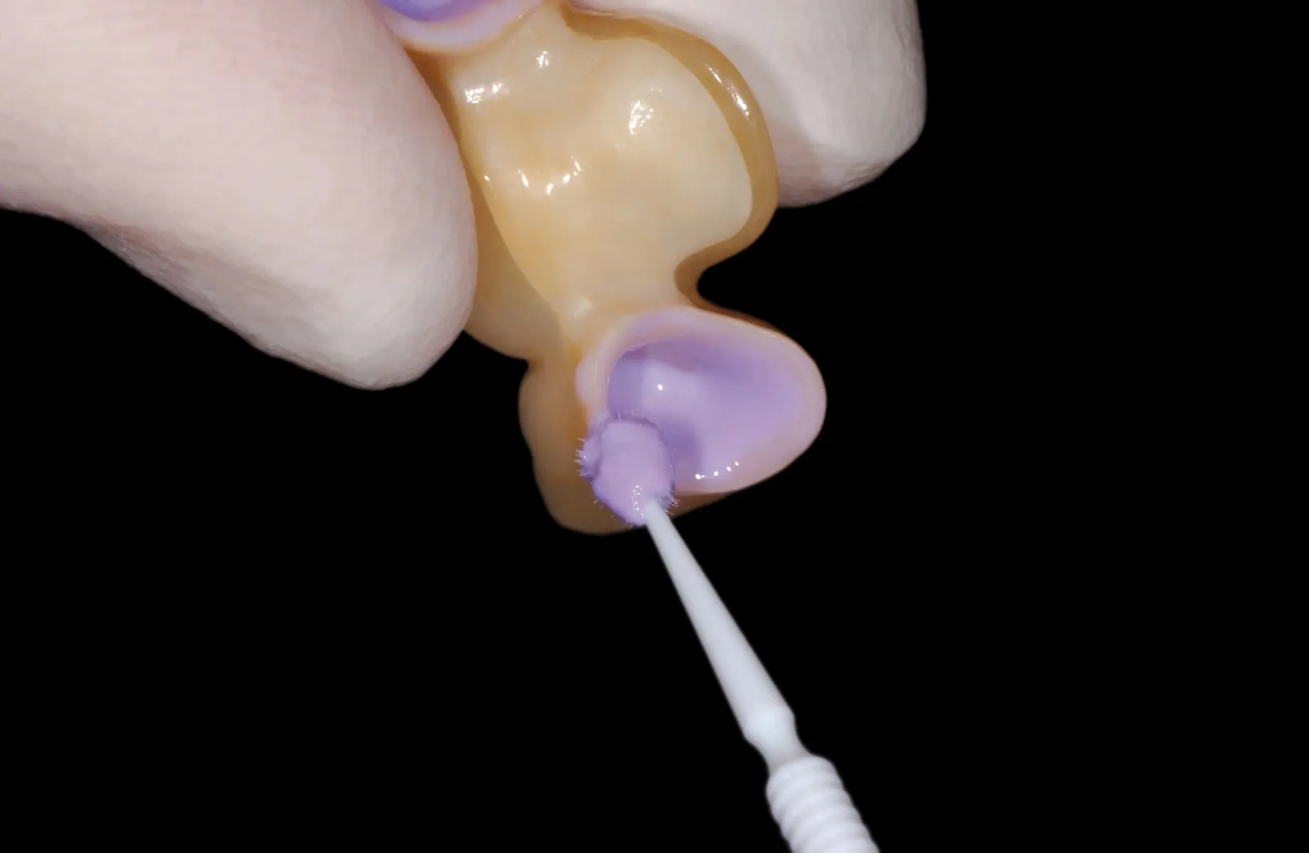 Buy Ivoclar Ivoclean Paste Online at Best Price | Dentalkart.com