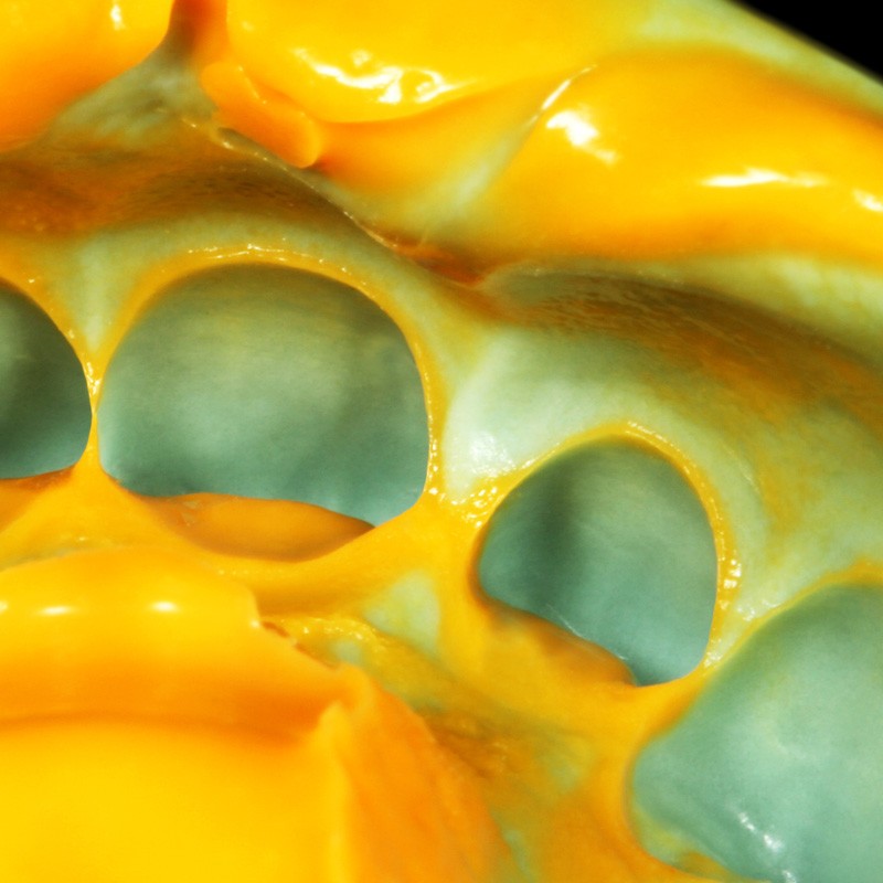 Zhermack Zetaplus Putty :- Buy C-Silicone dental Impression Material at ...