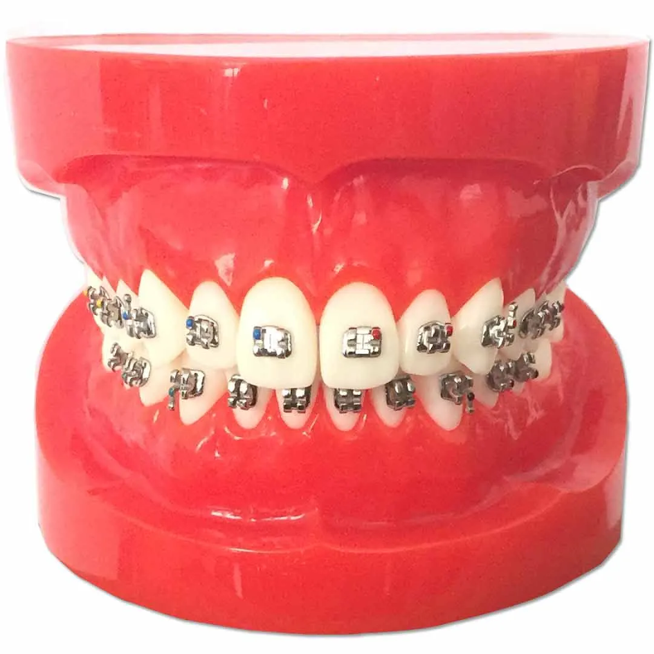 Buy Orthodontic Models Online | Braces Models Ortho at Dentalkart